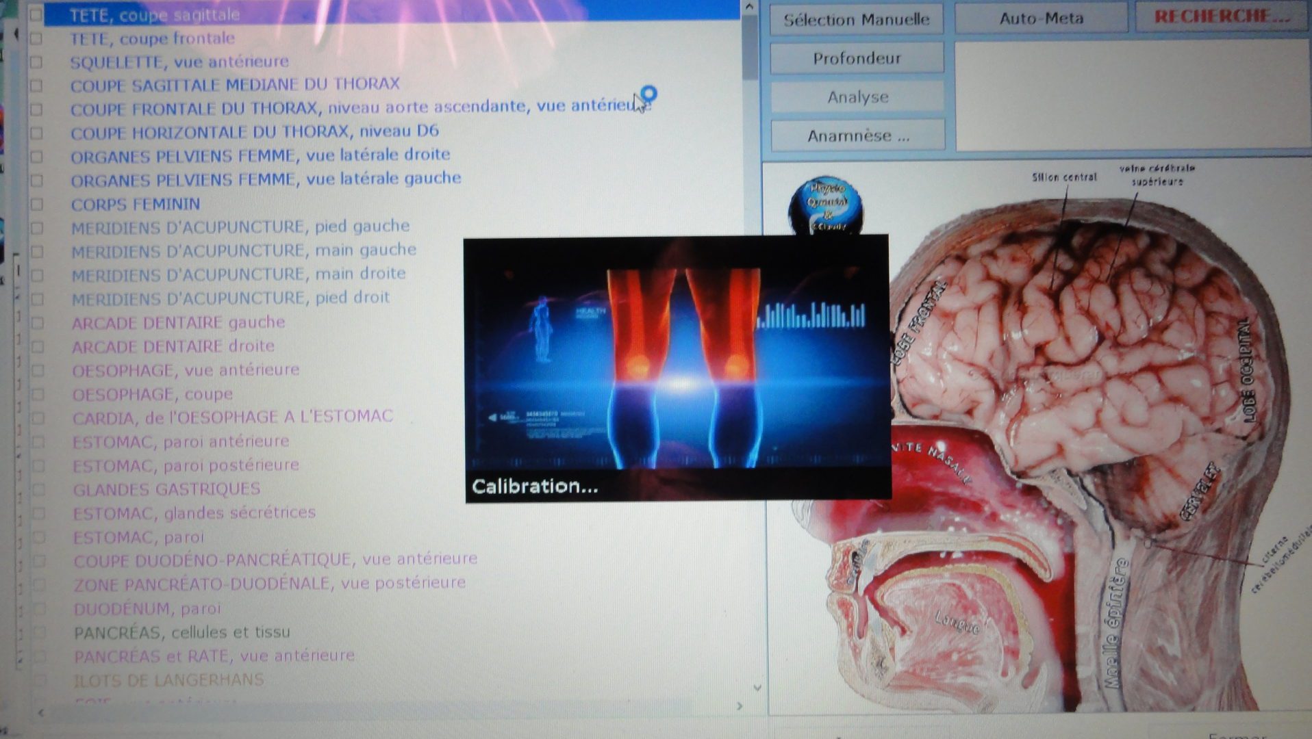 Bilan en naturopathie avec le PhysioScan - Déborah Naturopathe